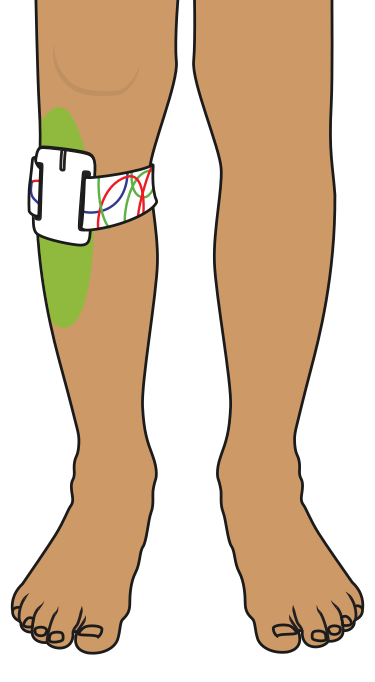 Frequently asked questions | NightWatch Epilepsy Seizure Detection