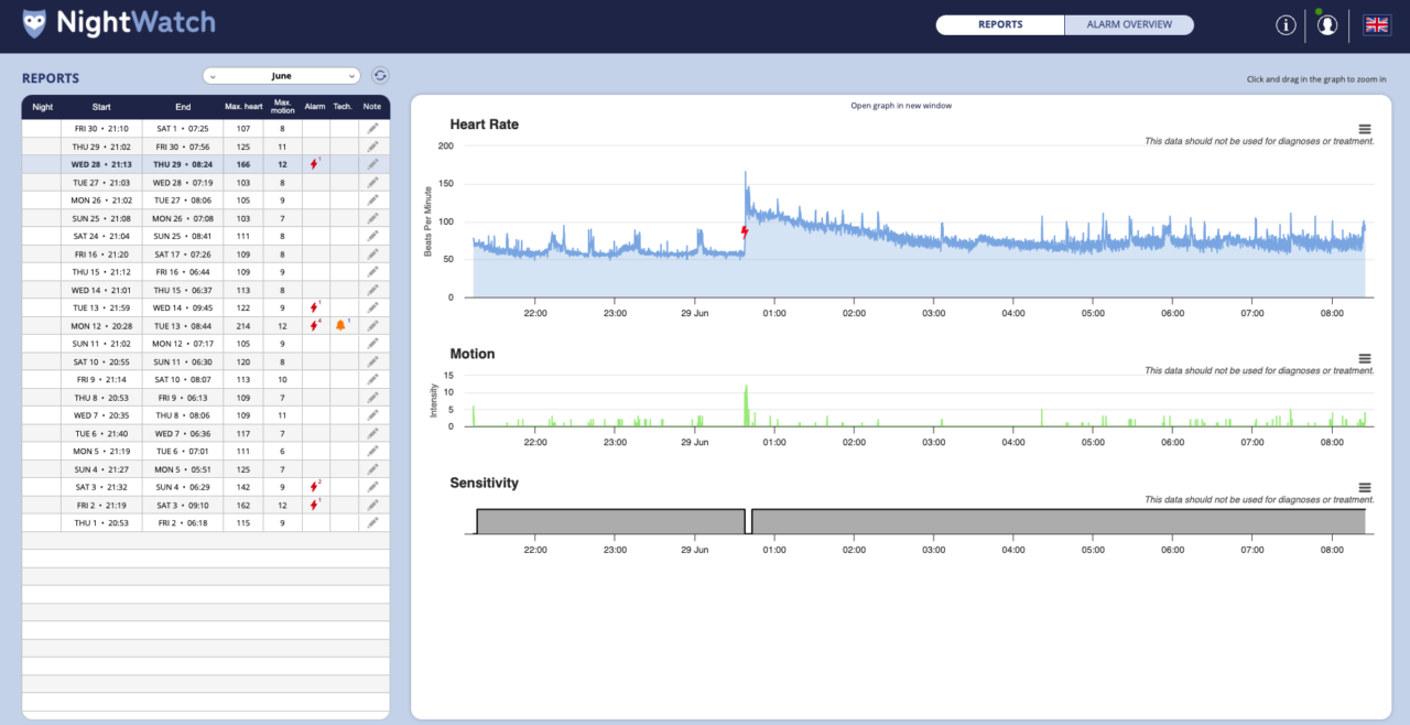 NightWatch+ | Epilepsy seizure detection during sleep